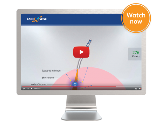 Gamma Probe Systems for Sentinel Node Biopsy & Other Applications ...